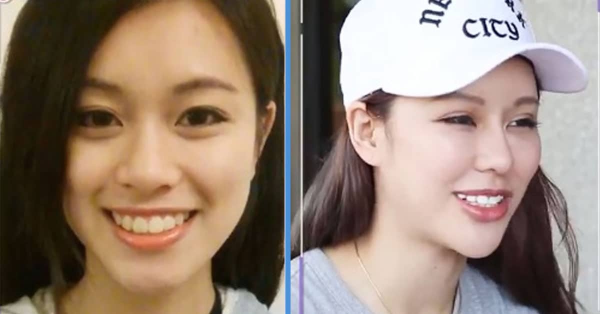 Pretty Girl Went for 30 Plastic Surgeries ‘Coz of Her Boyfriend’s ...