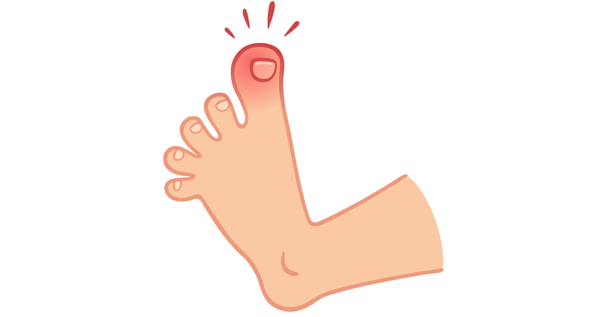 Here's The Scientific Reason Why Stubbing Your Toe Is So Super Painful ...