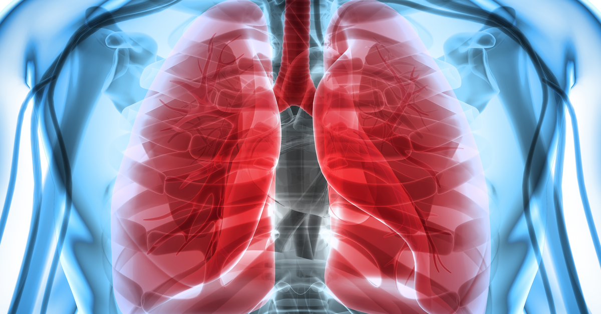 What Is Flu-Related Pneumonia, and How Often Is It Fatal? - Goody Feed