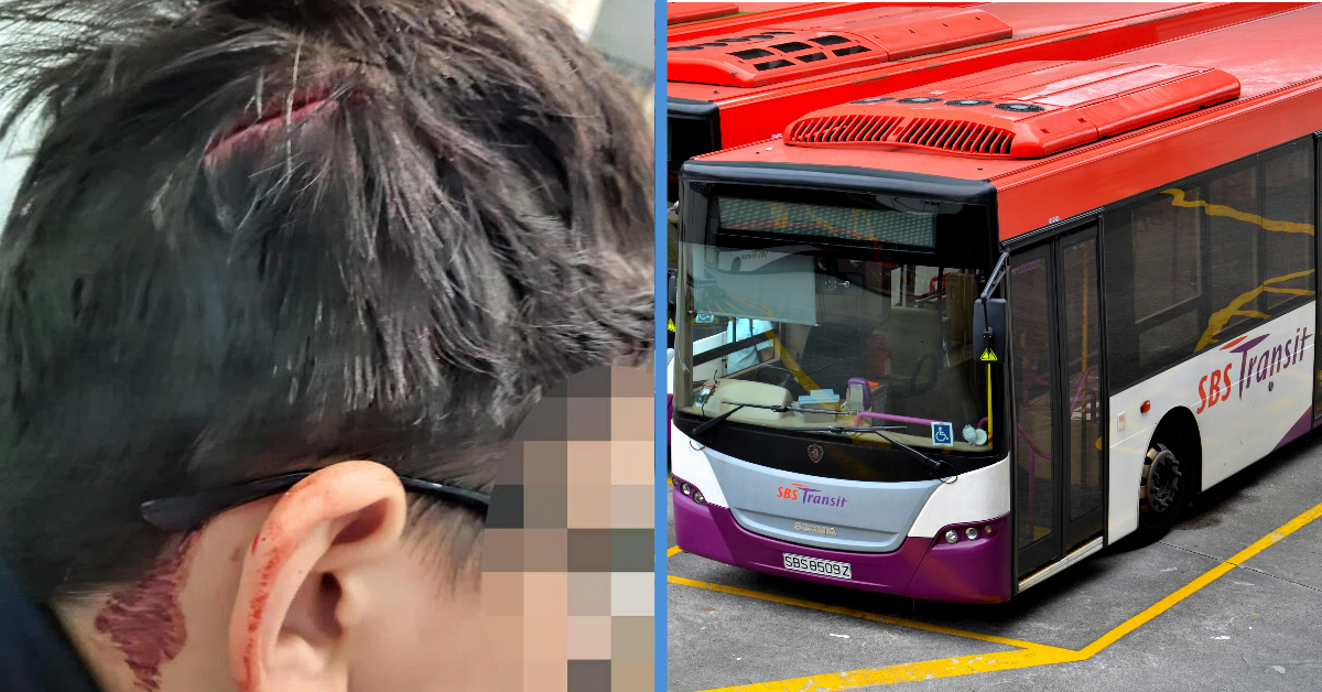10YO Fell Off SBS Bus Stairs While Bus is Moving; SBS Has Since ...
