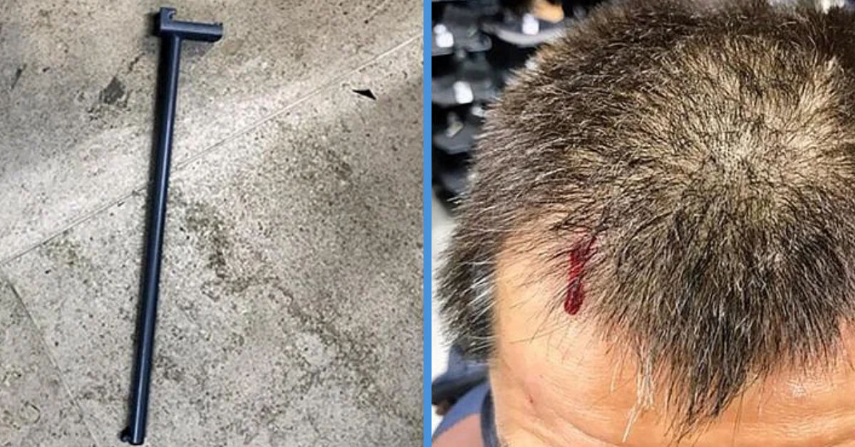 Metal Bar Suddenly Dropped on Man’s Head While He Was in JB City Square ...