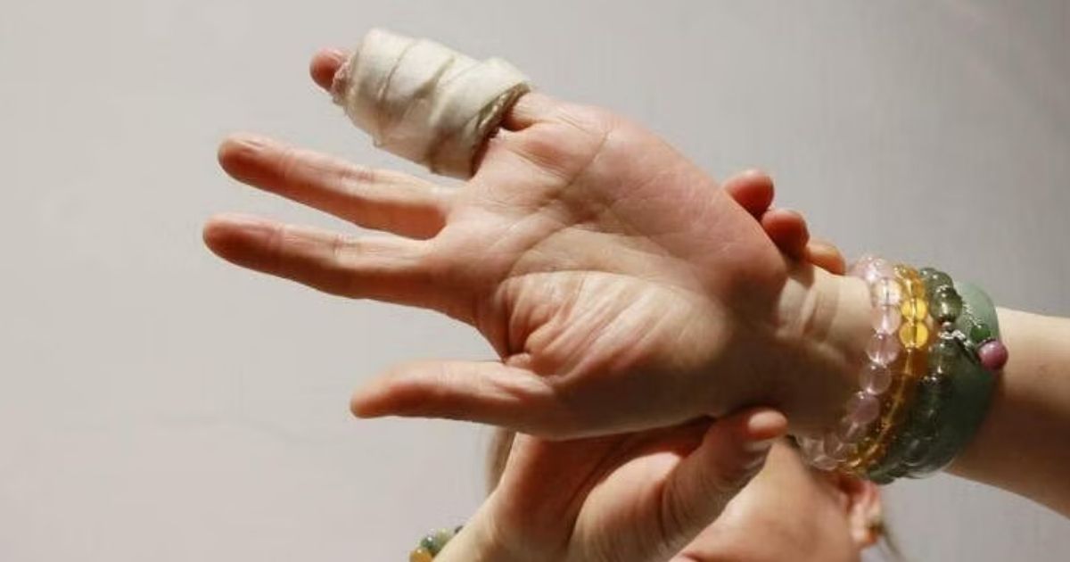 Woman's Hand Caught in MRT Doors, Leaving Her with Two Broken Fingers ...