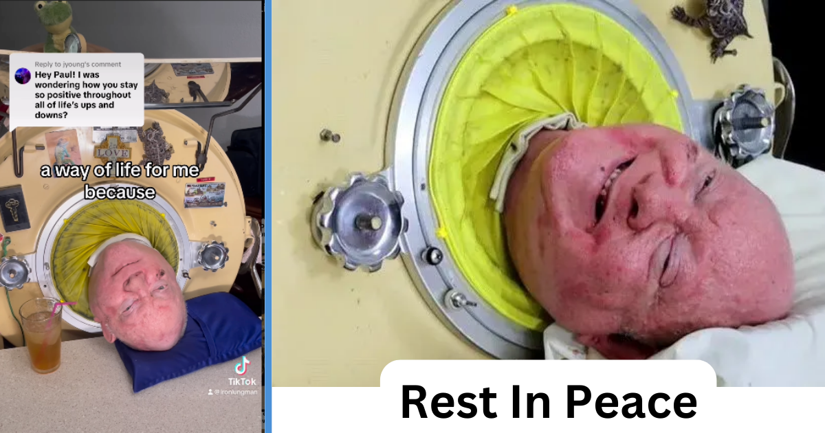 Paul Alexander, the Man in the Iron Lung, Dies at 78 - Goody Feed