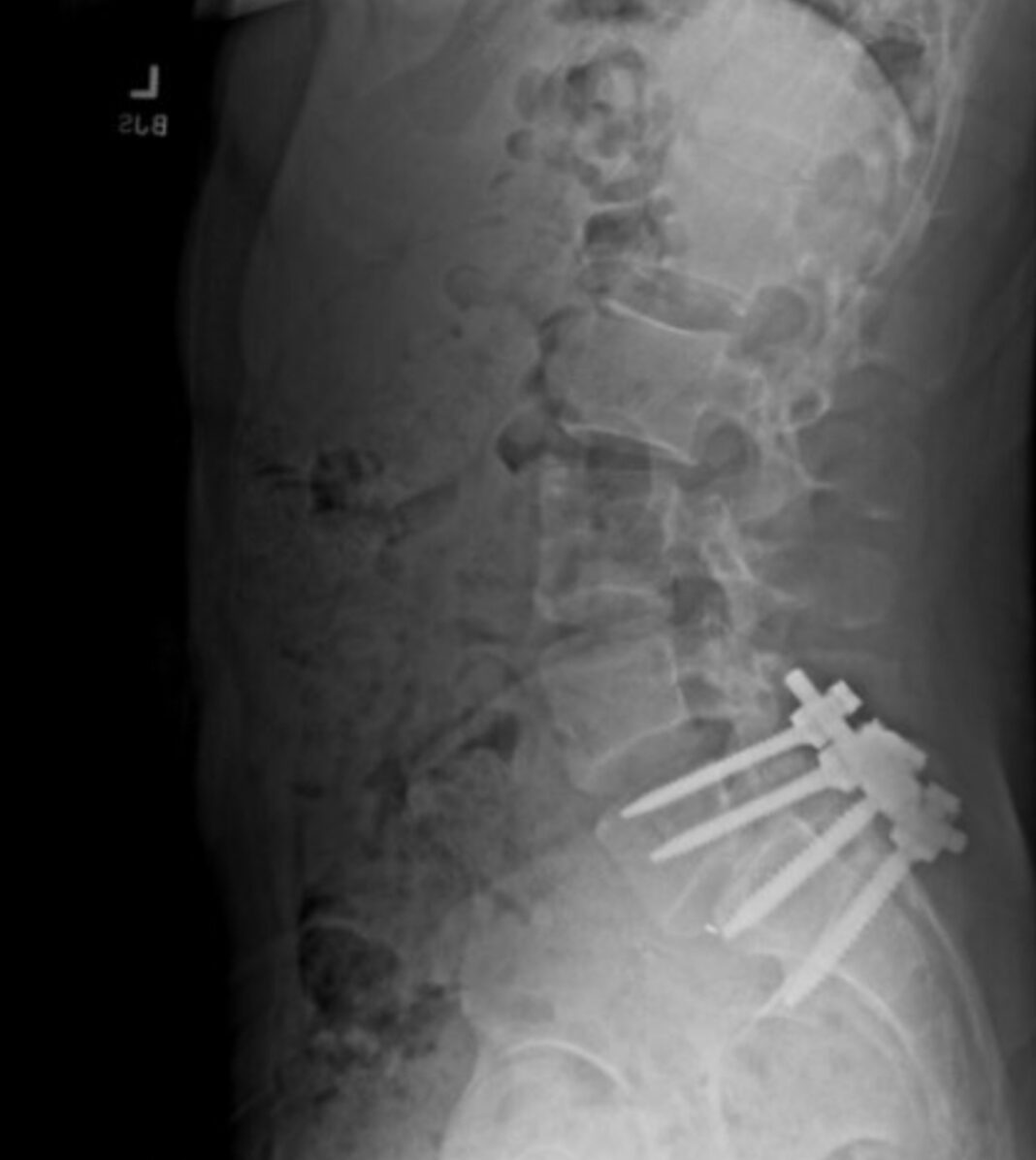 Everything About the UnitedHealthcare CEO’s Murder & His Killer ...