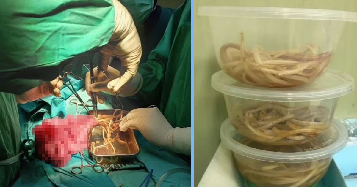 Three-Year-Old Indonesian Boy Undergoes Emergency Surgery for Massive ...